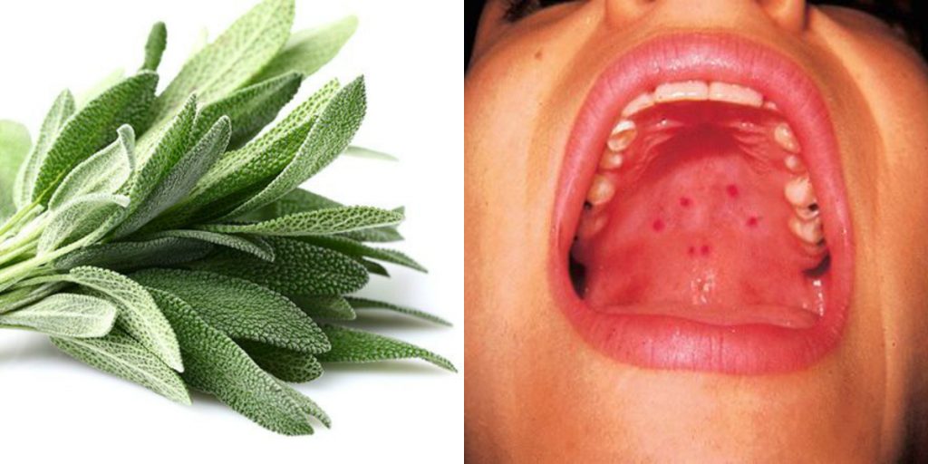 Sherbela ndihmon për sëmundjet e gojës – Ekonomia Online